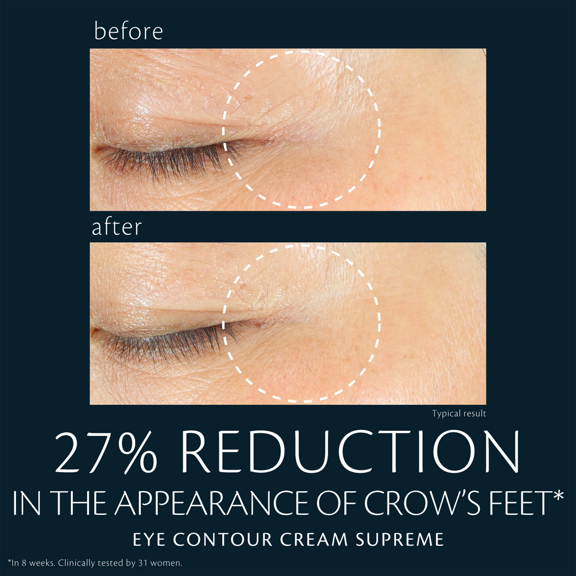 Eye Contour Cream Supreme | Clé de Peau Beauté