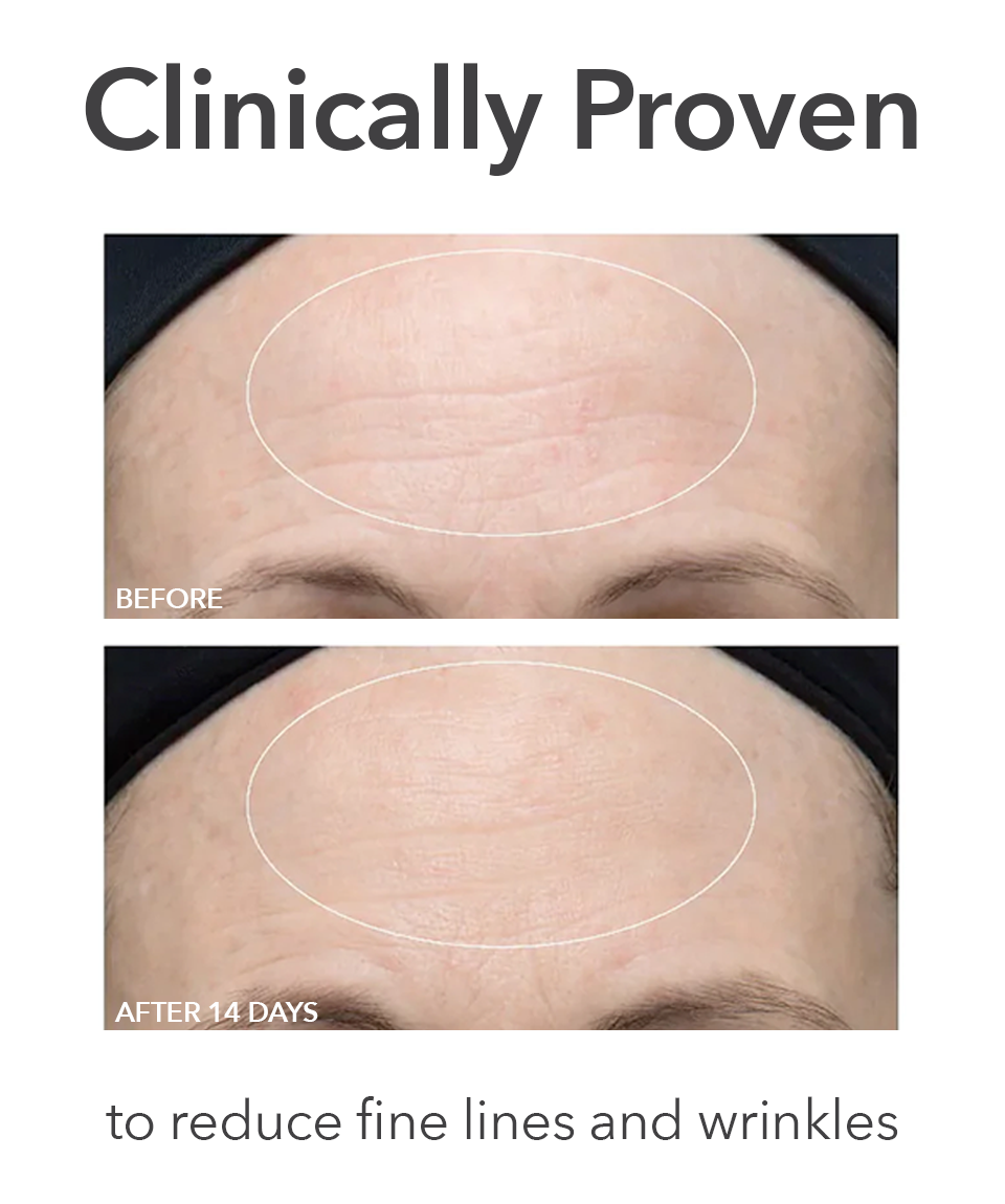 Alpha Beta® Ultra Gentle Daily Peel | Dr Dennis Gross